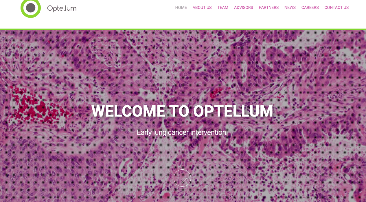 Optellum scores £1 million in funding from Luminous Ventures to tackle ...