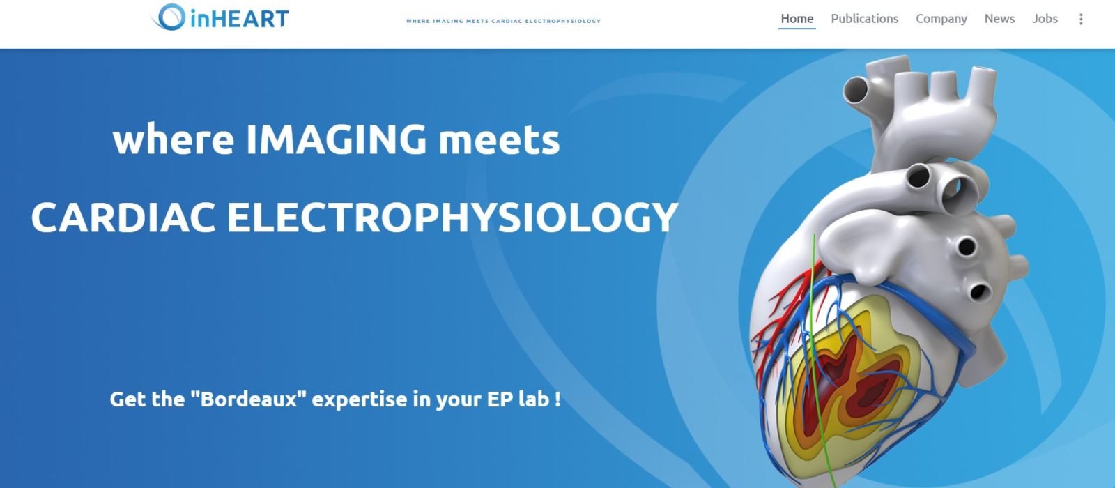 French startup inHEART raises €3.7 million to improve cardiac ...