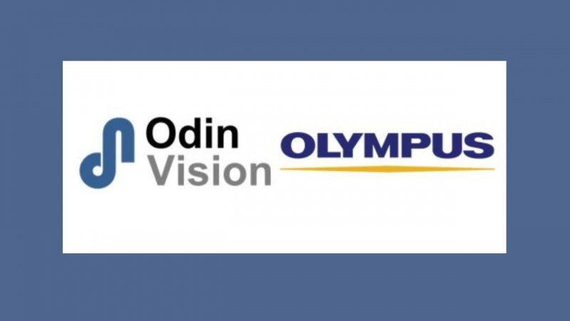 Olympus acquires UK AI endoscopy company Odin Vision in ‘up to’ £66 million deal - Tech.eu